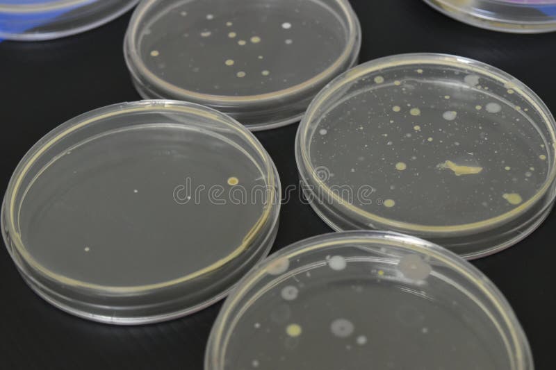 Colonies of Bacteria Growth on Agar Plate Stock Image - Image of ...