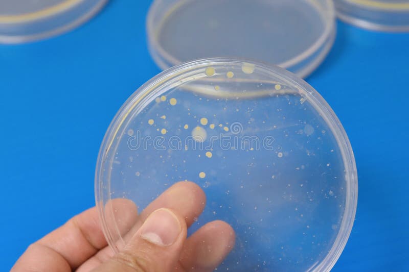 Colonies of Bacteria Growth on Agar Plate Stock Photo - Image of ...