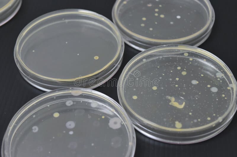 Colonies of Bacteria Growth on Agar Plate Stock Image - Image of ...