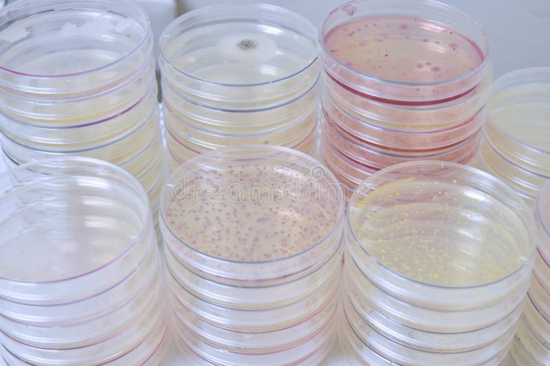 Colonies of Bacteria Growth on Agar Plate Stock Photo - Image of ...