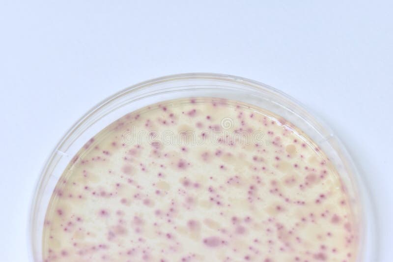 Colonies of Bacteria Growth on Agar Plate Stock Image - Image of ...