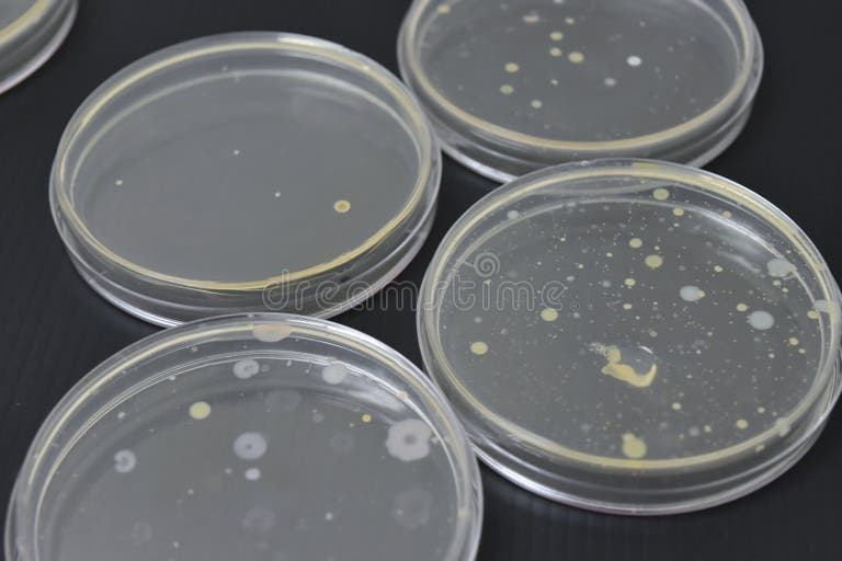 Colonies of Bacteria Growth on Agar Plate Stock Image - Image of ...