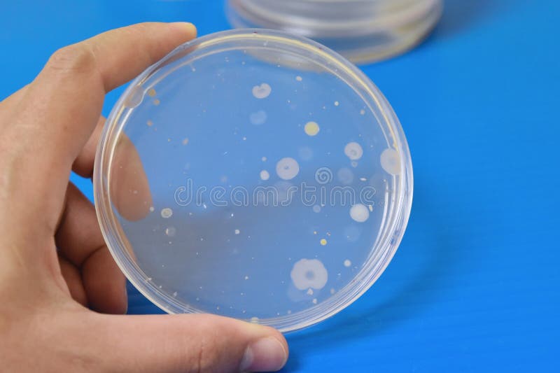 Colonies of Bacteria Growth on Agar Plate Stock Photo - Image of ...