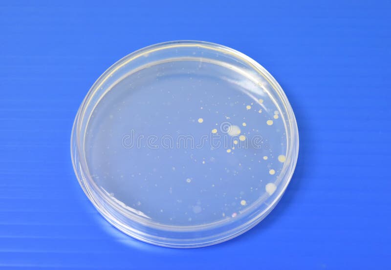 Colonies of Bacteria Growth on Agar Plate Medium in Laboratory Stock ...