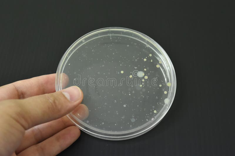 Colonies of Bacteria Growth on Agar Plate Medium in Laboratory Stock ...