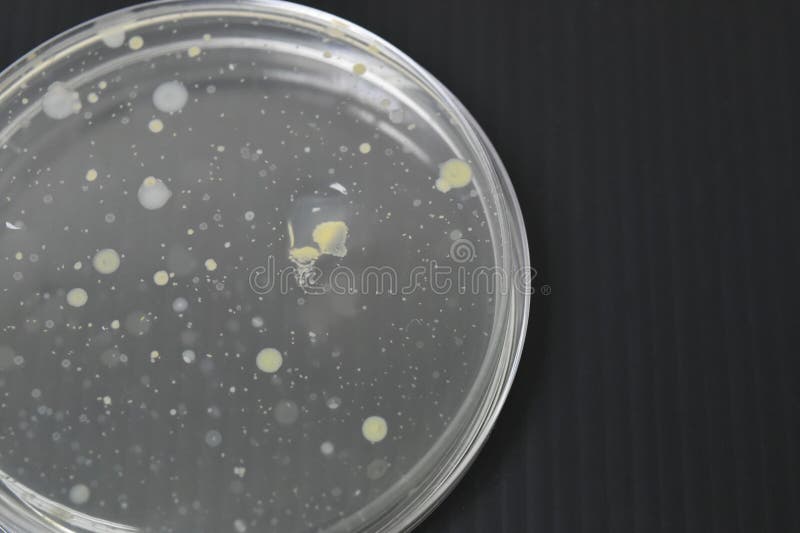 Colonies of Bacteria Growth on Agar Plate Medium in Laboratory Stock ...