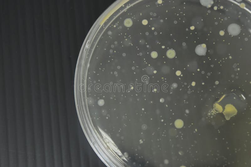Colonies of Bacteria Growth on Agar Plate Medium in Laboratory Stock ...