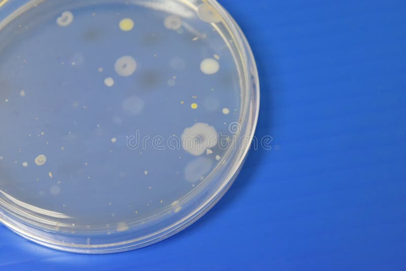 Colonies of Bacteria Growth on Agar Plate Medium in Laboratory Stock ...