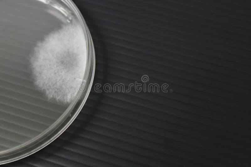 Colonies of Bacteria Growth on Agar Plate Medium in Laboratory Stock ...