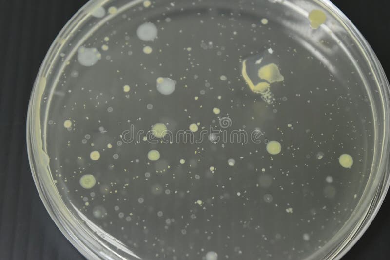 Bacteria Growth on Plate Count Agar Stock Photo - Image of tobago ...