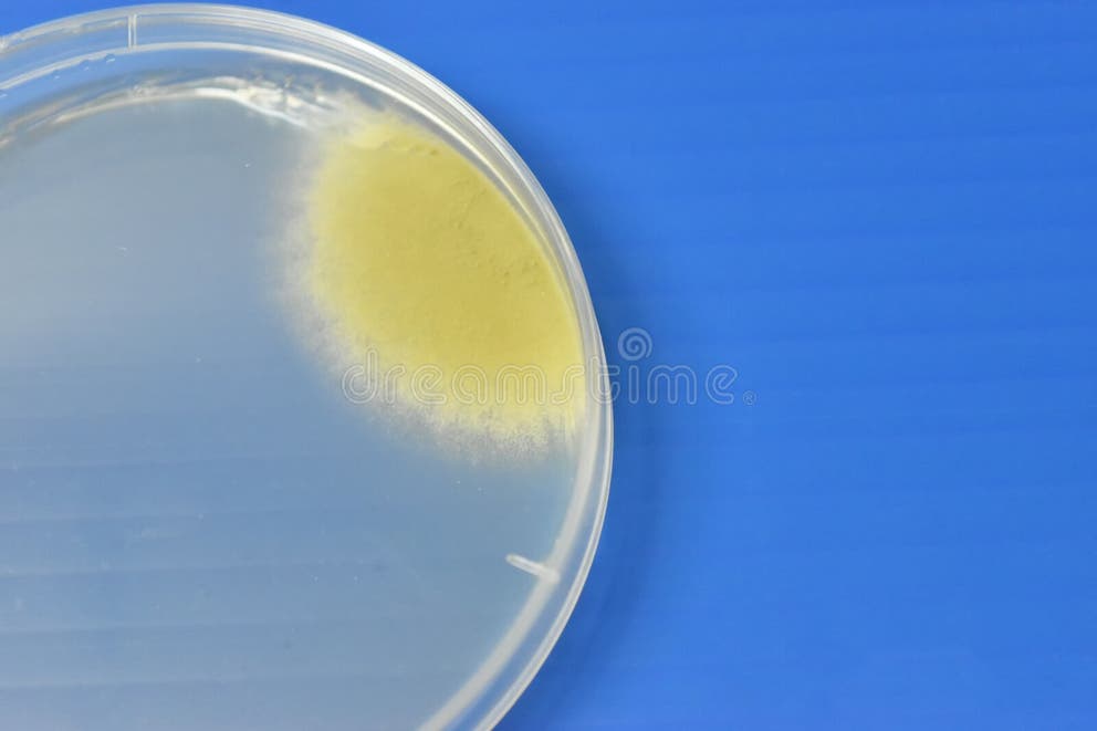 Colonies of Bacteria Growth on Agar Plate Medium in Laboratory Stock ...