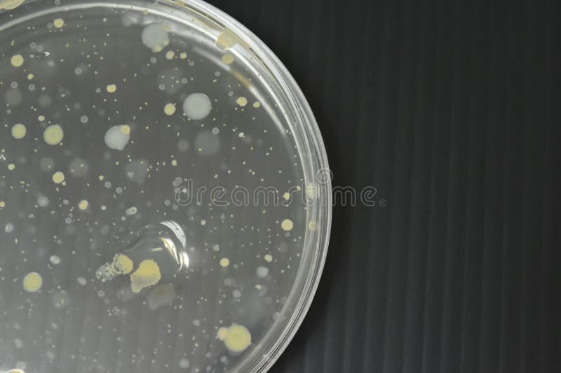 Bacteria Growth on Plate Count Agar Stock Photo - Image of tobago ...