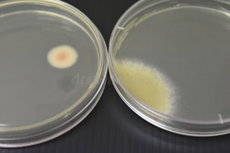 Bacteria Growth on Plate Count Agar Stock Photo - Image of tobago ...