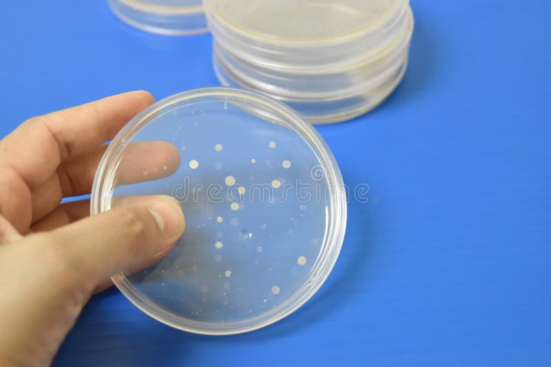 Bacteria Growth on Plate Count Agar Stock Photo - Image of tobago ...