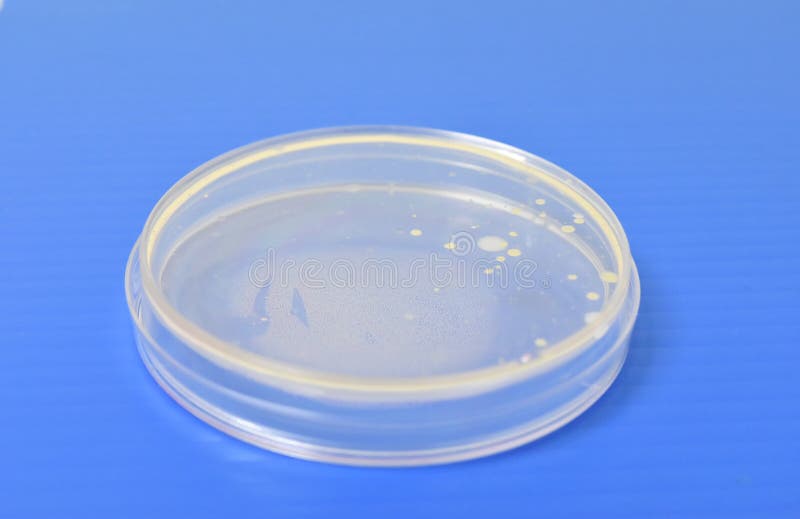 Colonies of Bacteria Growth on Agar Plate Medium in Laboratory Stock ...