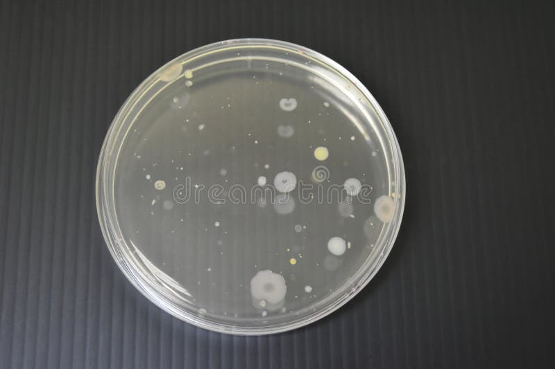 Colonies of Bacteria Growth on Agar Plate Medium in Laboratory Stock ...
