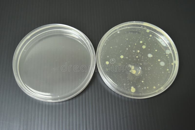 Colonies of Bacteria Growth on Agar Plate Medium in Laboratory Stock ...
