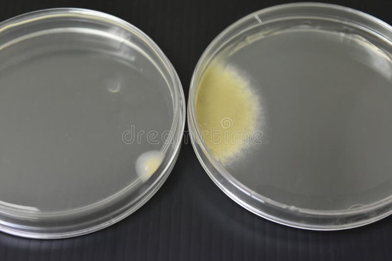 Colonies of Bacteria Growth on Agar Plate Medium in Laboratory Stock ...