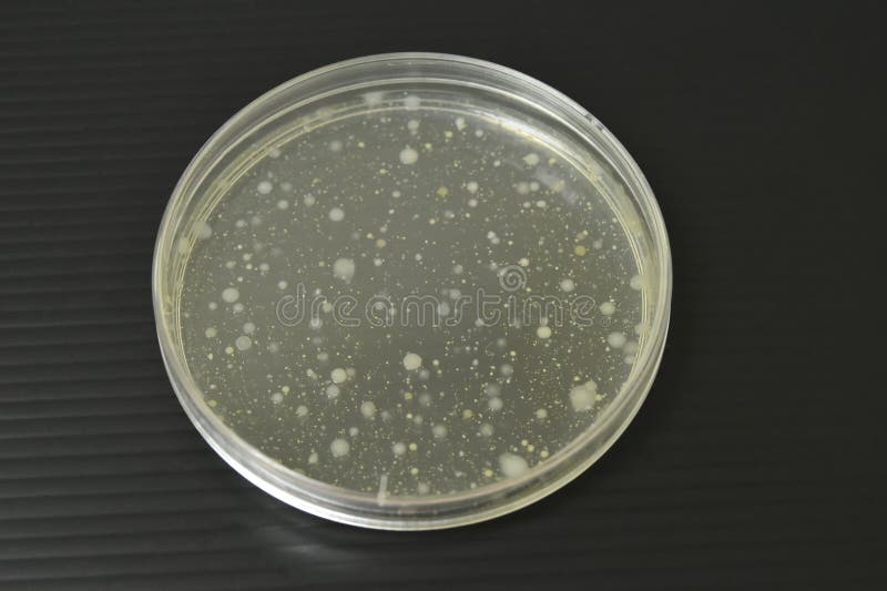 Colonies of Bacteria Growth on Agar Plate Medium in Laboratory Stock ...