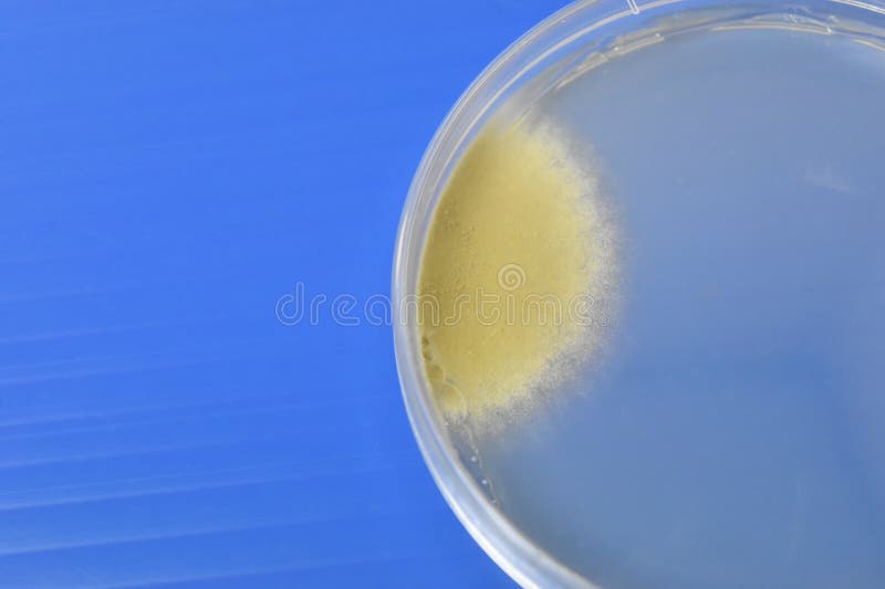 Colonies of Bacteria Growth on Agar Plate Medium in Laboratory Stock ...
