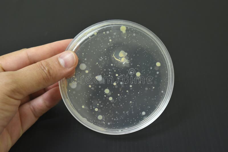 Colonies of Bacteria Growth on Agar Plate Medium in Laboratory Stock ...