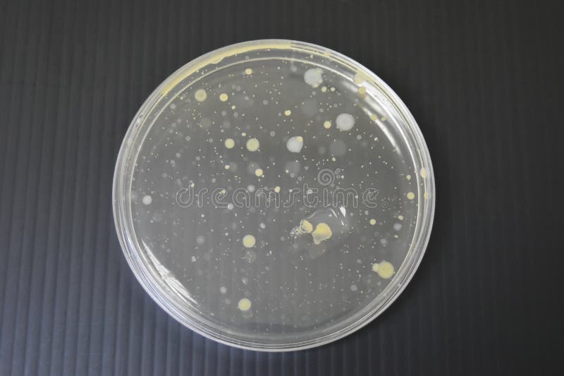 Colonies of Bacteria Growth on Agar Plate Medium in Laboratory Stock ...