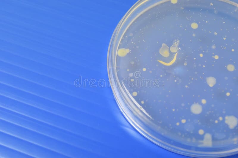 Colonies of Bacteria Growth on Agar Plate Medium in Laboratory Stock ...