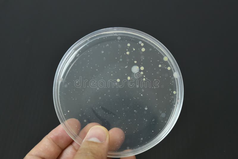 Colonies of Bacteria Growth on Agar Plate Medium in Laboratory Stock ...