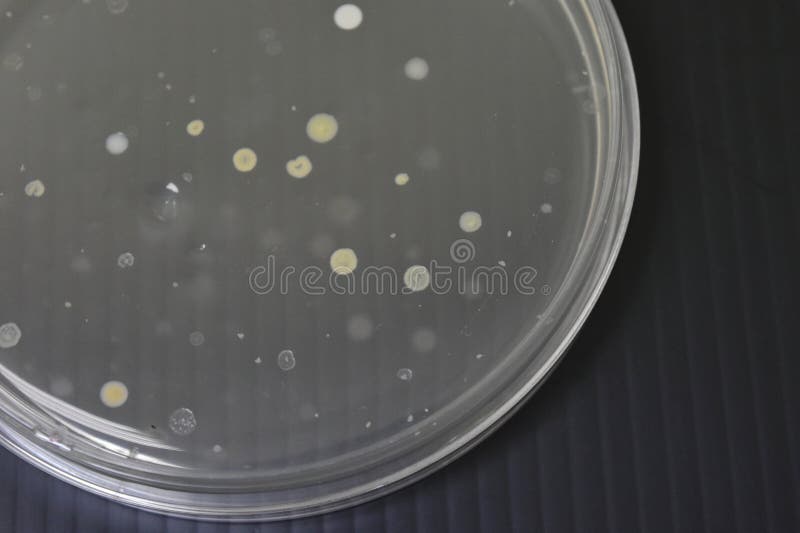 Colonies of Bacteria Growth on Agar Plate Medium in Laboratory Stock ...