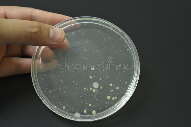 Colonies of Bacteria Growth on Agar Plate Medium in Laboratory Stock ...