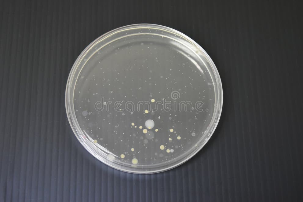 Colonies of Bacteria Growth on Agar Plate Medium in Laboratory Stock ...