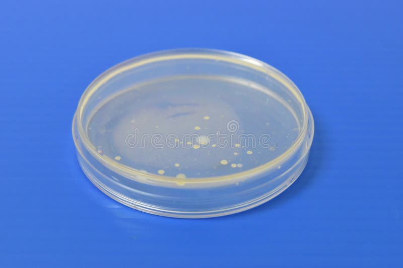 Colonies of Bacteria Growth on Agar Plate Medium in Laboratory Stock ...