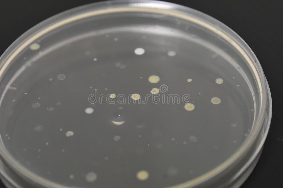 Colonies of Bacteria Growth on Agar Plate Medium in Laboratory Stock ...
