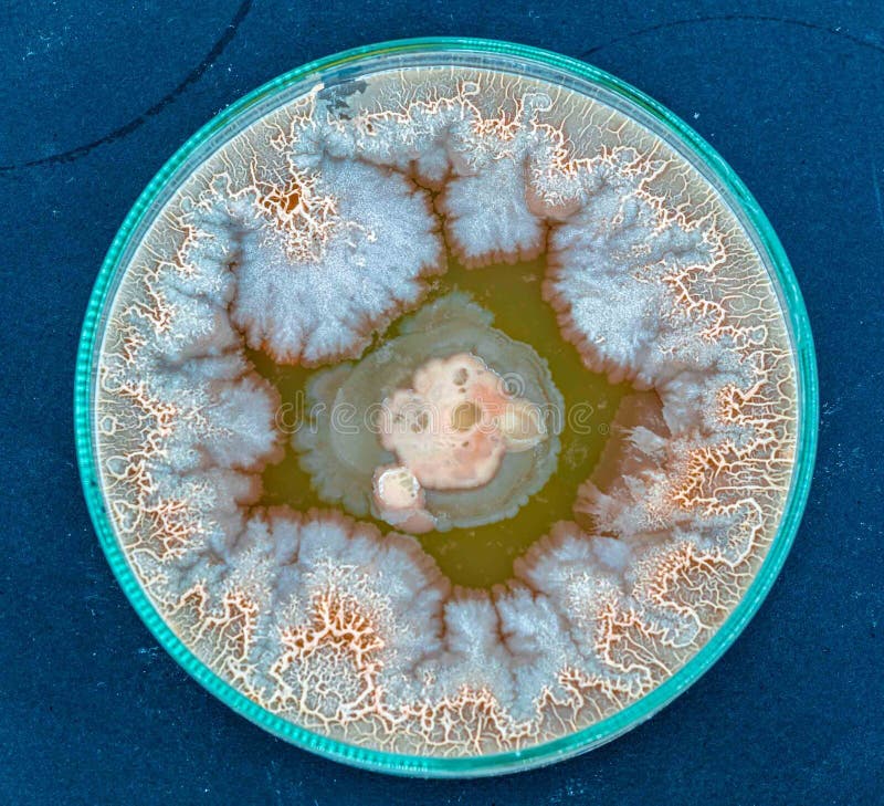 Colonies of Bacteria and Microorganisms on the Surface of Agar and Wind ...