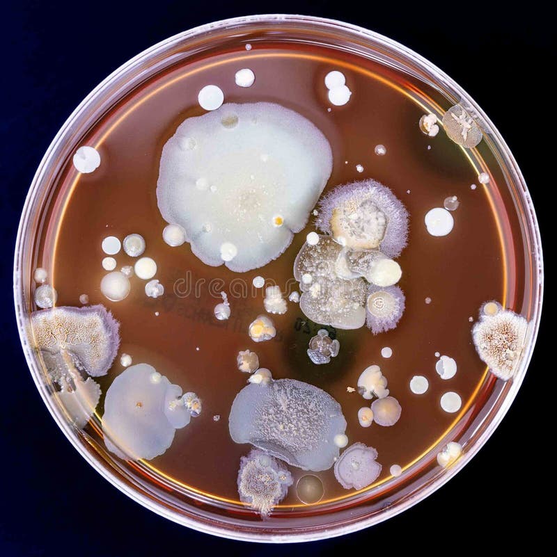 Colonies of Bacteria and Microorganisms on the Surface of Agar and Wind ...