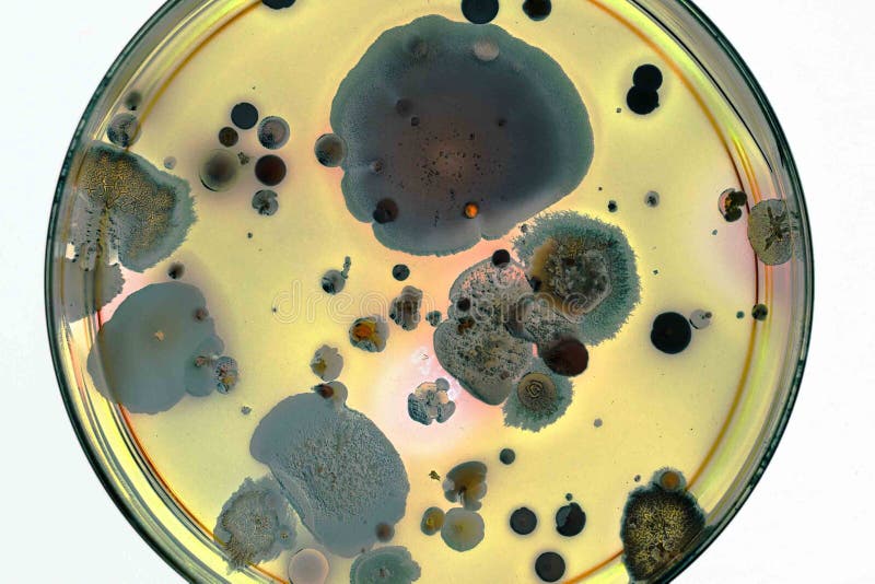 Colonies of Bacteria and Microorganisms on the Surface of Agar and Wind ...