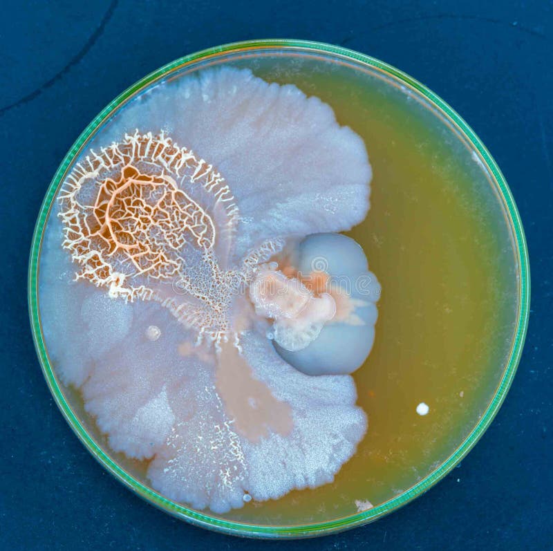 Colonies of Bacteria and Microorganisms on the Surface of Agar and Wind ...