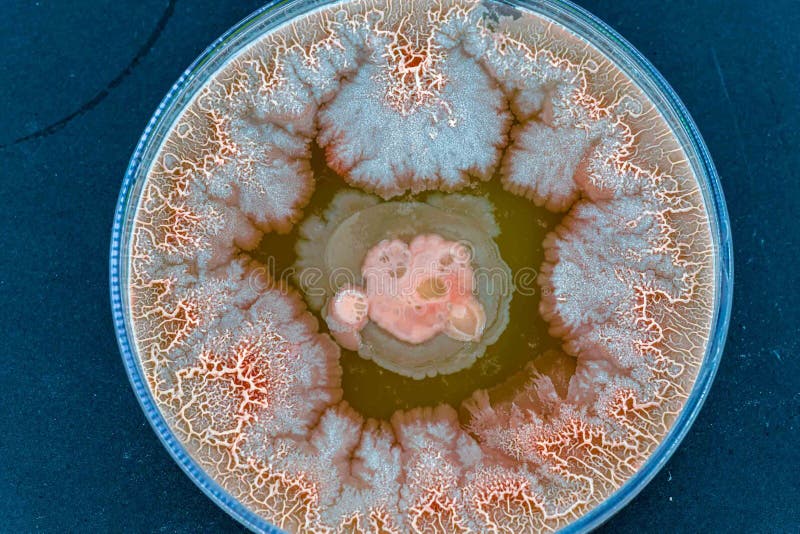 Colonies of Bacteria and Microorganisms on the Surface of Agar and Wind ...