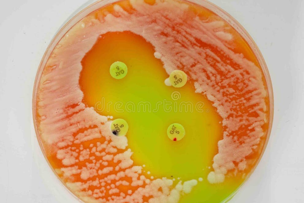 Colonies of Bacteria and Microorganisms on the Surface of Agar and Wind ...