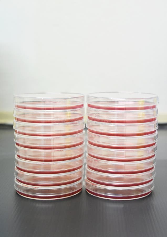 Colonies of Bacteria in Petri Dish Stock Image - Image of biochemistry ...