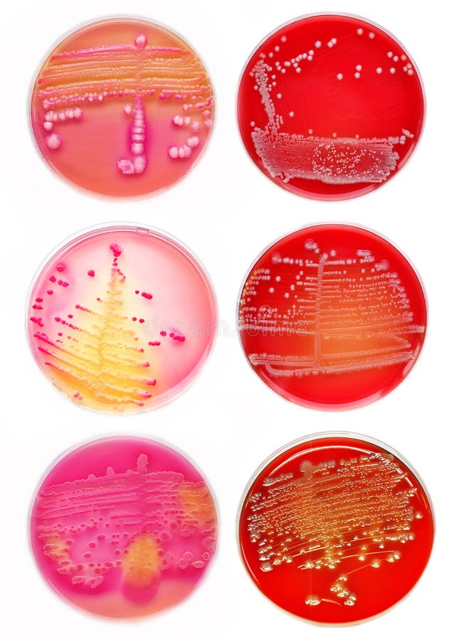 Croissance De Colonies De Bactéries Sur La Boîte De Pétri De Plaque D ...