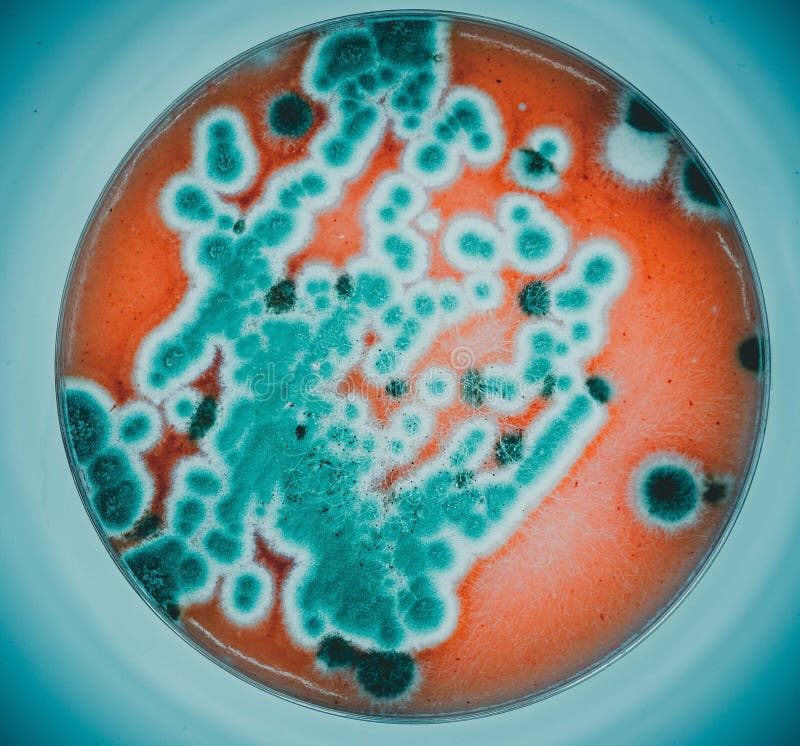 Colonies of microorganisms stock photo. Image of culture - 276190518