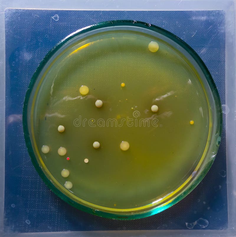 Colonies of Pathogenic Bacteria in a Petri Dish, Microbiological ...