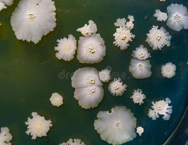 Colonies of Pathogenic Bacteria in a Petri Dish, Microbiological ...