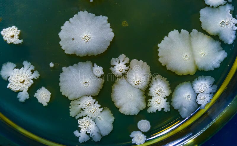 Colonies of Pathogenic Bacteria in a Petri Dish, Microbiological ...
