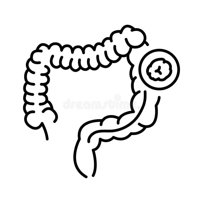 Colonotomy line black icon stock vector. Illustration of colectomy ...