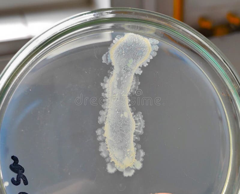 Bacterial Colony on Nutrient Agar Medium Stock Image - Image of ...