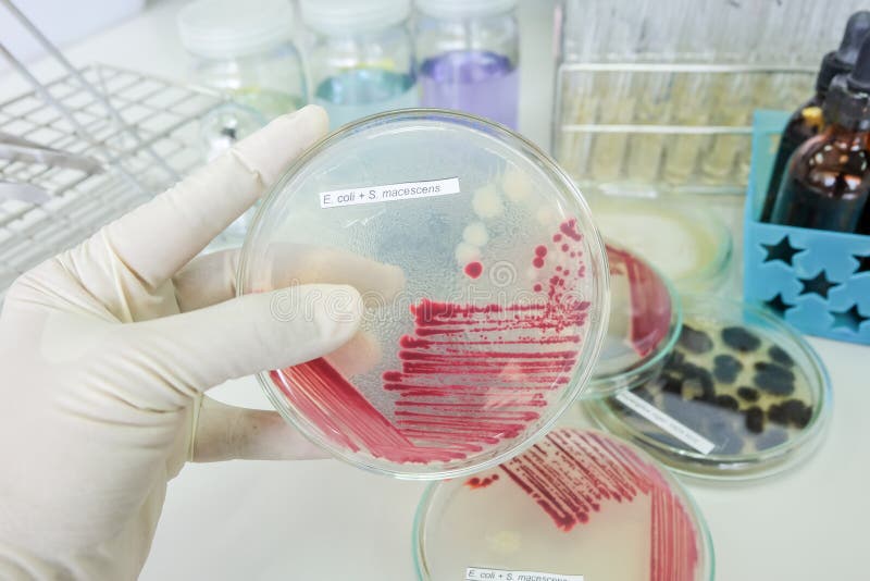 Red colony of bacteria stock photo. Image of biotechnology - 93206882