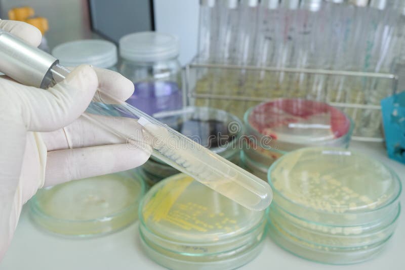 Colony of bacteria stock photo. Image of penicillin, bacterial - 93206558