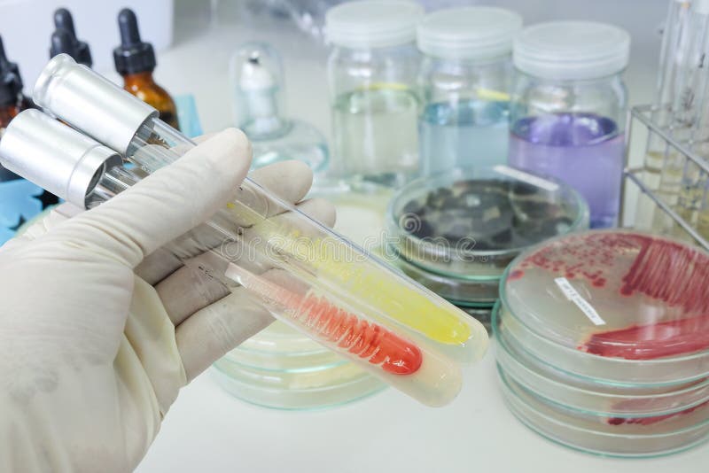 Colony of bacteria stock image. Image of biotechnology - 93206619